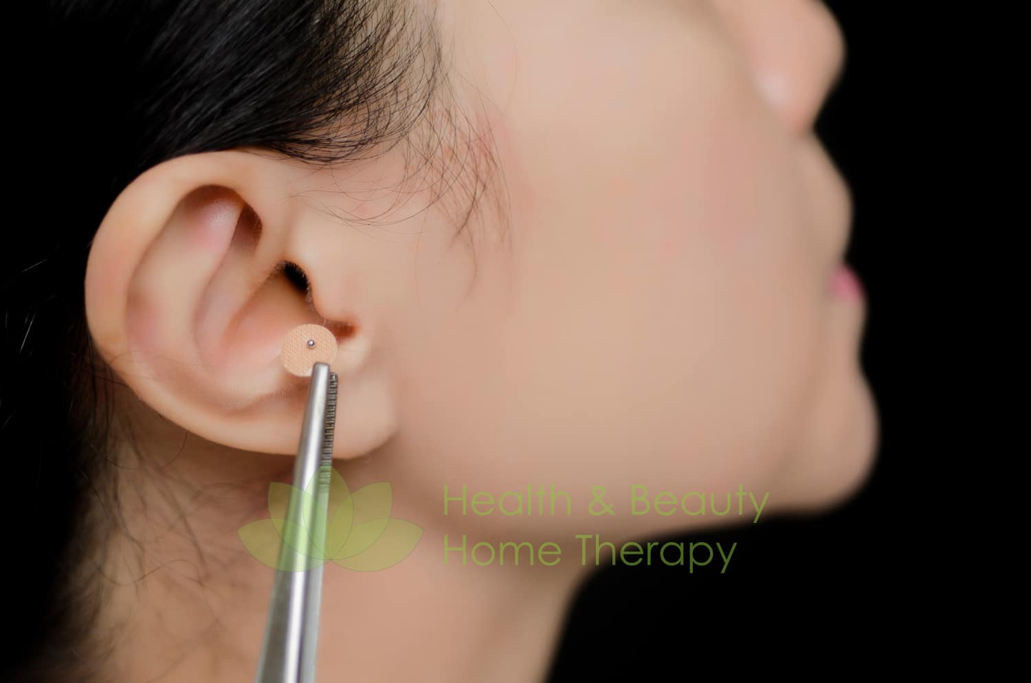 Empishin (Press Tack Needles) | Health & Beauty Home Therapy